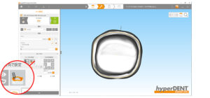 hyperdent - 株式会社you＆my