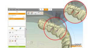 hyperdent - 株式会社you＆my