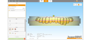 hyperdent - 株式会社you＆my